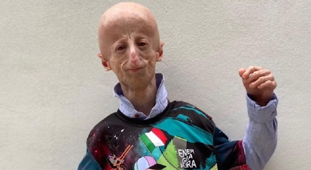 Sammy Basso, morto all'età di 28 anni: Chi era? La sua storia e la malattia